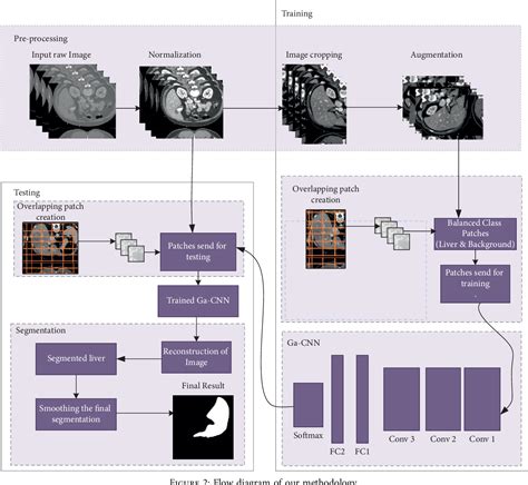 Figure 2 From A Lightweight Convolutional Neural Network Model For Liver Segmentation In Medical