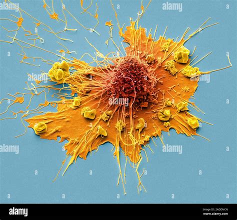 Fibroblast Cell Coloured Scanning Electron Micrograph Of A Mammalian Fibroblast Culture Cell