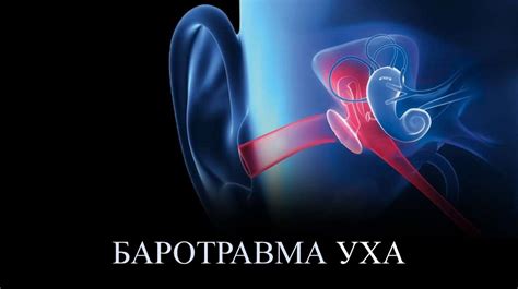 Баротравма уха презентация онлайн