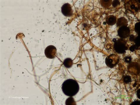 Rhizopus Stolonifer Sob Microscopio E8a09301 Philip Harris Prepared