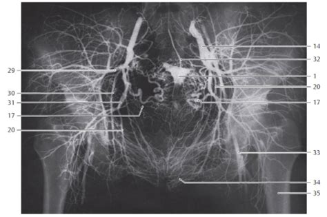 Arteriogram Of Female Pelvis Vessels Diagram Quizlet