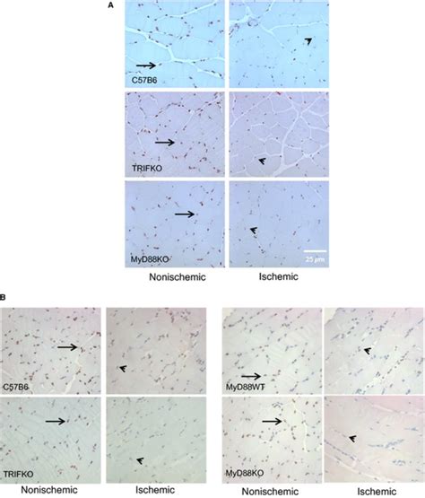 Immunohistochemistry Evaluating Hmgb1 Staining Brown Arrow In Download Scientific Diagram