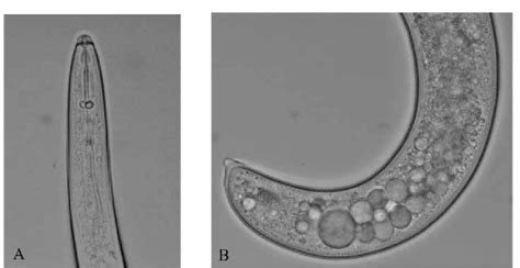 Características De La Hembra Del Nemátodo Fitoparásito Helicotylenchus