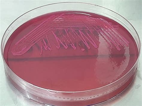 Staphylococcus Haemolyticus Introduction Morphology Pathogenicity