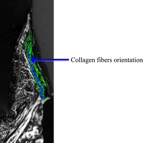 Collagen Fibers Orientation In The Connective Tissue The Fibers Were Download Scientific
