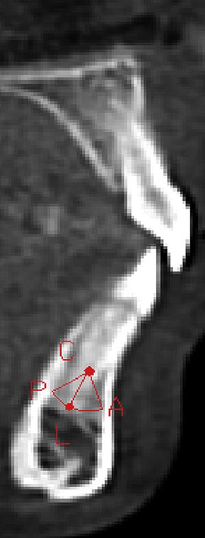 Variables Calculated With AutoCAD Download Scientific Diagram