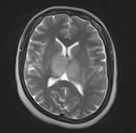 Abdi D Posted On Linkedin