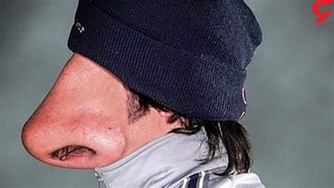 جنجال ماجرای دماغ گلابی ها در ایران باورنکردنی عکس