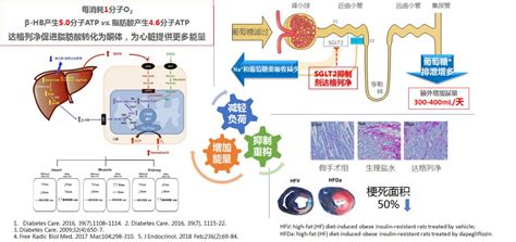 ESC2019DAPA HF试验结果公布达格列净显著改善射血分数降低心衰患者的临床预后 心力衰竭和心肌病网