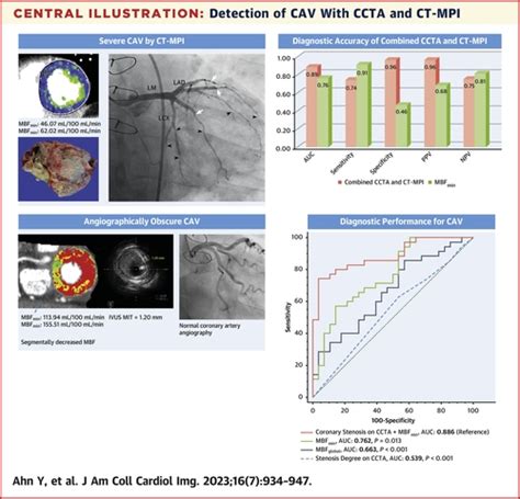 Jacc Cardiovascular Imaging Vol 16 No 7