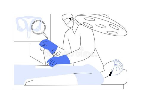 Pelvic Laparoscopy Stock Illustrations 11 Pelvic Laparoscopy Stock