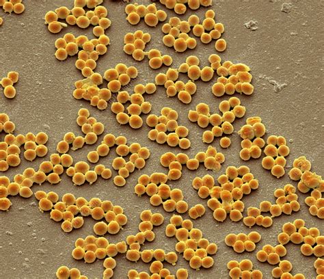 Streptococcus Group A Under A Microscope Streptococcus Group A Under A Microscope