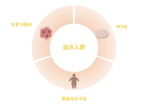 从未成熟到新生命：卵母细胞体外成熟技术魔法大揭秘 郑州大学第三附属医院