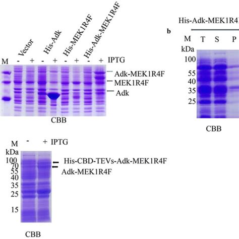 Expression Of Recombinant Proteins In Escherichia Coli A 15 Sds Page