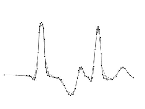 Overfitting Vs Underfitting In Machine Learning Algorithms Artificial