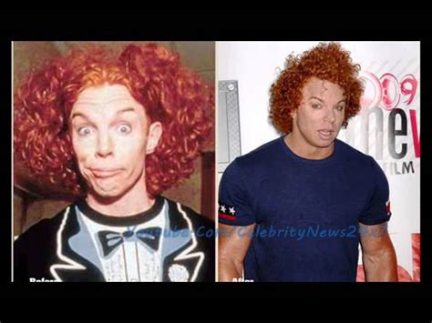 Carrot Top Surgery Gone Bad