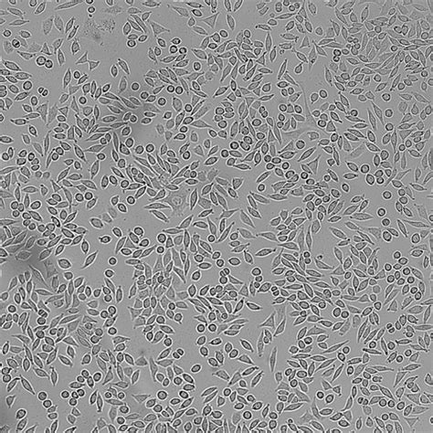 Nctc Clone 929 [l Cell L 929]细胞（小鼠成纤维细胞）