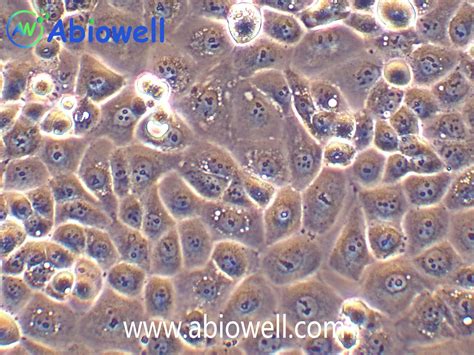 Ea Hy926 Ea Hy926 人脐静脉细胞融合细胞 （str鉴定） 艾碧维生物官网