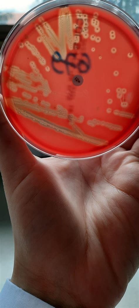 Streptococcus Pyogenes Is An Important Global Human Pathogen That Causes A Wide Variety Of Acute