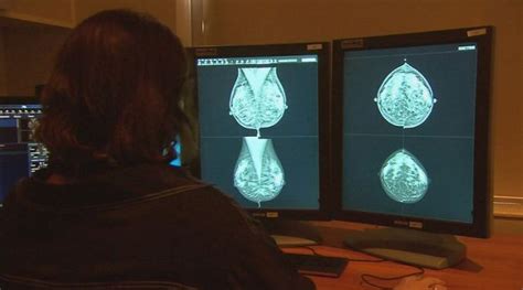 ඉදිරි වසර 22 දී ඔස්ට්‍රේලියාවෙන් පිළිකා මරණ ලක්ෂ 15 ක් Auslanka Tv Australian News For The