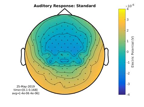 Preprocessing And Event Related Potentials In Eeg Data Fieldtrip Toolbox