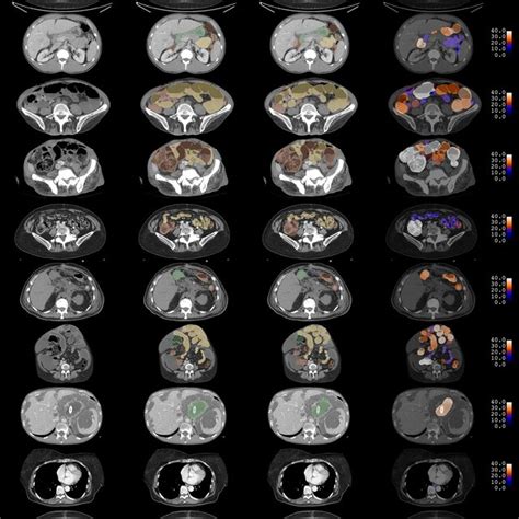 Examples Of Manual And Visual Annotation Each Row Corresponds To A Download Scientific Diagram