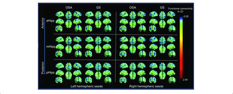 The Distribution Patterns Of Resting State Functional Connectivity