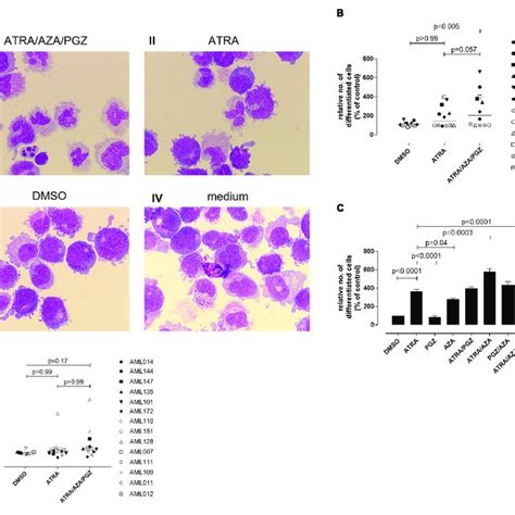 Cell Growth And Apoptosis Of Primary Aml Blasts A B Primary Aml Download Scientific