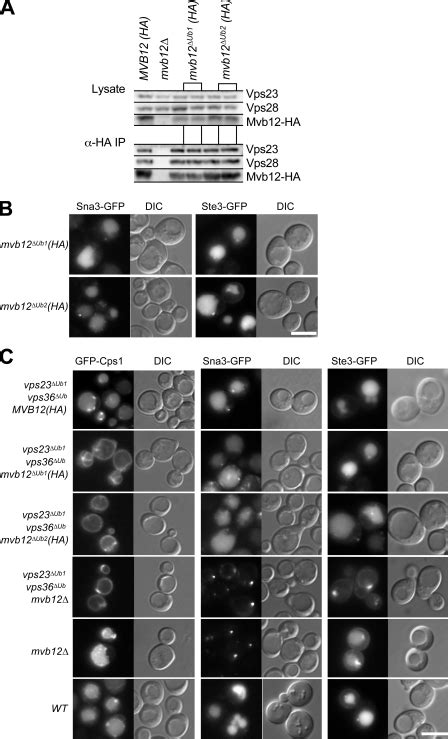 Ub Binding By Mvb12 Contributes To Gfp Cps1 Sorting A Mvb12 Mutants