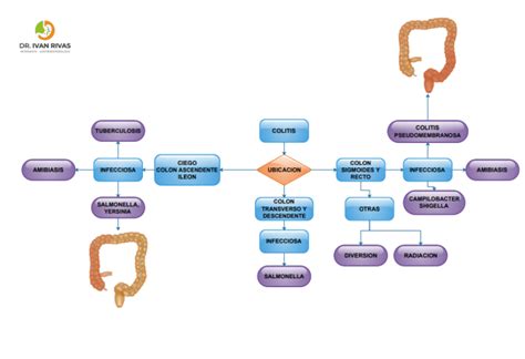 Algoritmos diagnósticos de la Colitis Gastro Mérida