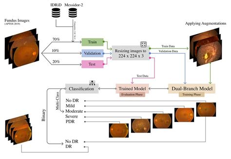 Proposed Framework For Detection And Stage Grading Of Diabetic Retinopathy Download