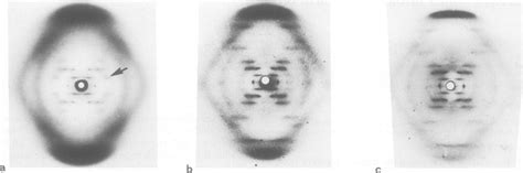 X Ray Diffraction Pattern Dna