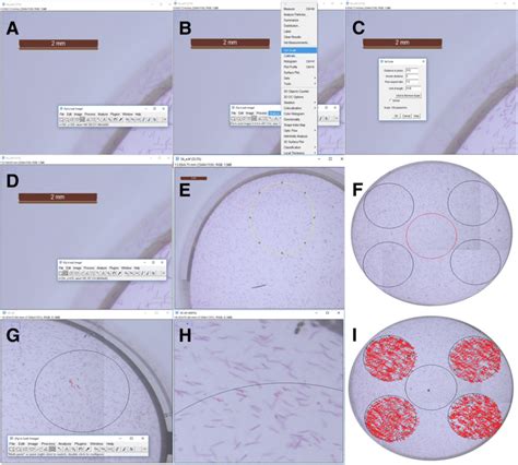 The Sequence Of Steps In Using Imagej Software A Calibration Of