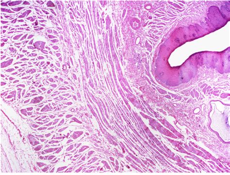 Esophagus Lower Third Cross Section Diagram Quizlet