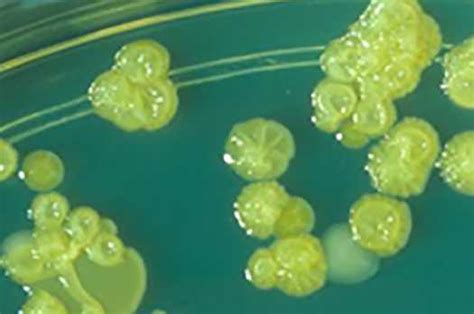 Home Cronobacter Cdc