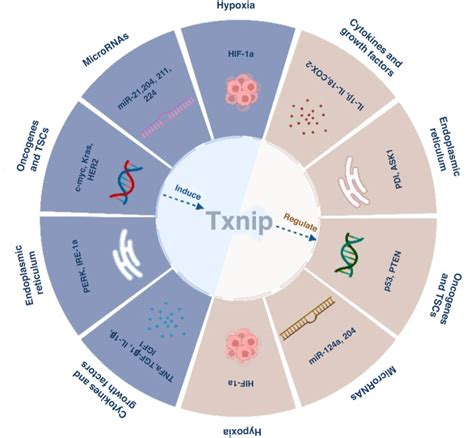 The Role Of Txnip In Cancer A Fine Balance Between Redox Metabolic And Immunological Tumor