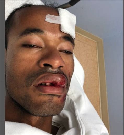 Council To Consider Settling Police Brutality Lawsuit Puna Mother