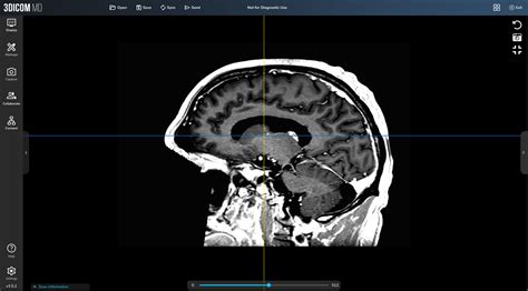 La Importancia De La Neuroimagen Y La Neurorradiología En El