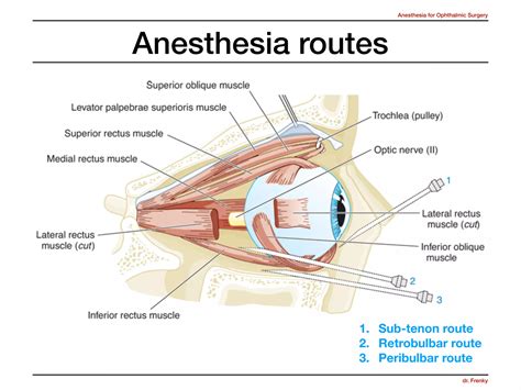Anesthesia For Ophthalmic Surgery Pdf