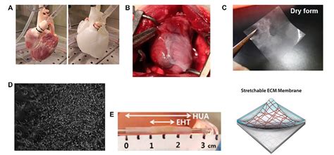 Figure 1 From Applications Of Tissue Decellularization Techniques In Ventricular Myocardial