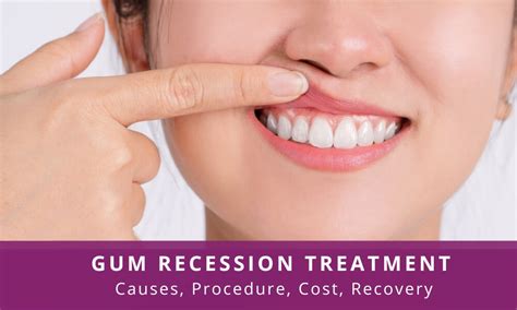 Gum Recession Treatment Causes Procedure Cost Recovery Richardson