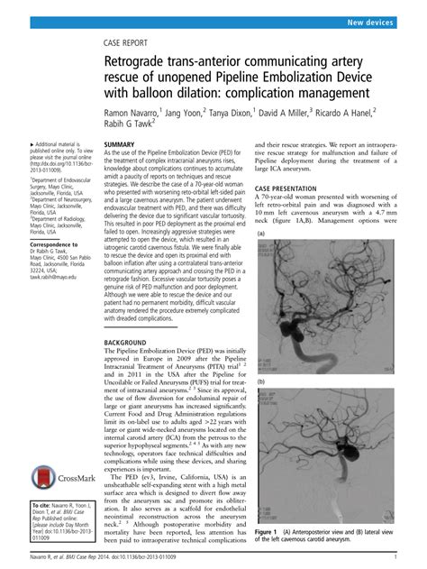 Pdf Retrograde Trans Anterior Communicating Artery Rescue Of Unopened Pipeline Embolization