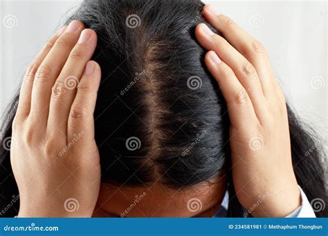 A Woman Has Problems With Hair And Scalp Stock Image Image Of Health Discomfort