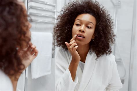 Home Remedies For Cold Sores 12 Homemade Treatments