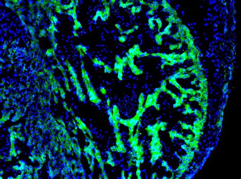 Plexin D1 Antibody Bsa Free Nbp1 33634 Novus Biologicals