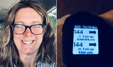 Diabetic Chemist Builds Biohacked Device To Treat The Disease Daily Mail Online