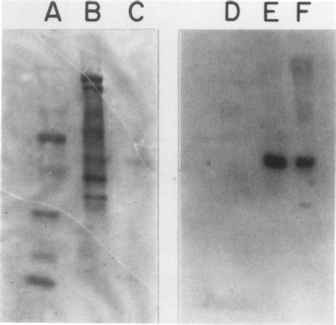 Immunochemical Identification Of The Aromatase Protein In Human Download Scientific Diagram