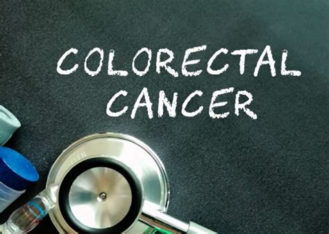 Us Team Designs Novel Mapping Of Colorectal Cancer Juta Medicalbrief