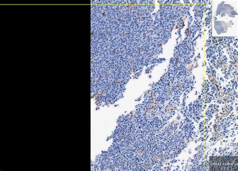 Empty Tiles In Cell Detection Usage Issues Image Sc Forum