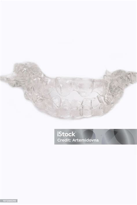 보이지 않는 치과 치아 괄호 Aligners 플라스틱 지지대 치과 보유자 치아를 치아 건강관리와 의술에 대한 스톡 사진 및 기타